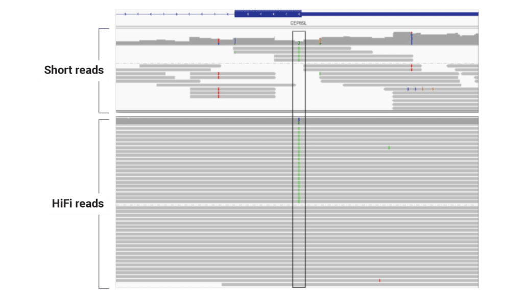 Sequencing 101: Whole Genome Sequencing for Rare Diseases