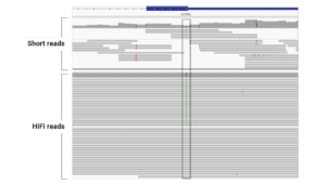 Sequencing 101: Whole Genome Sequencing for Rare Diseases